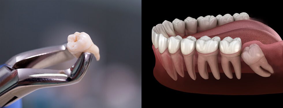 Kazakevičiaus klinika: Marijampolėje | protiniai dantys | dantų šalinimas